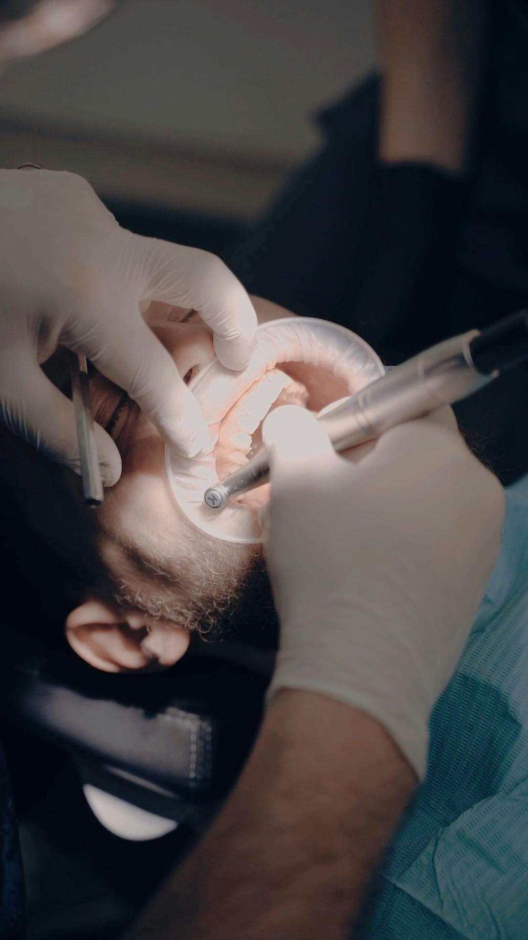 A Person Having Tooth Extraction Free Stock Video Footage, Royalty-Free ...