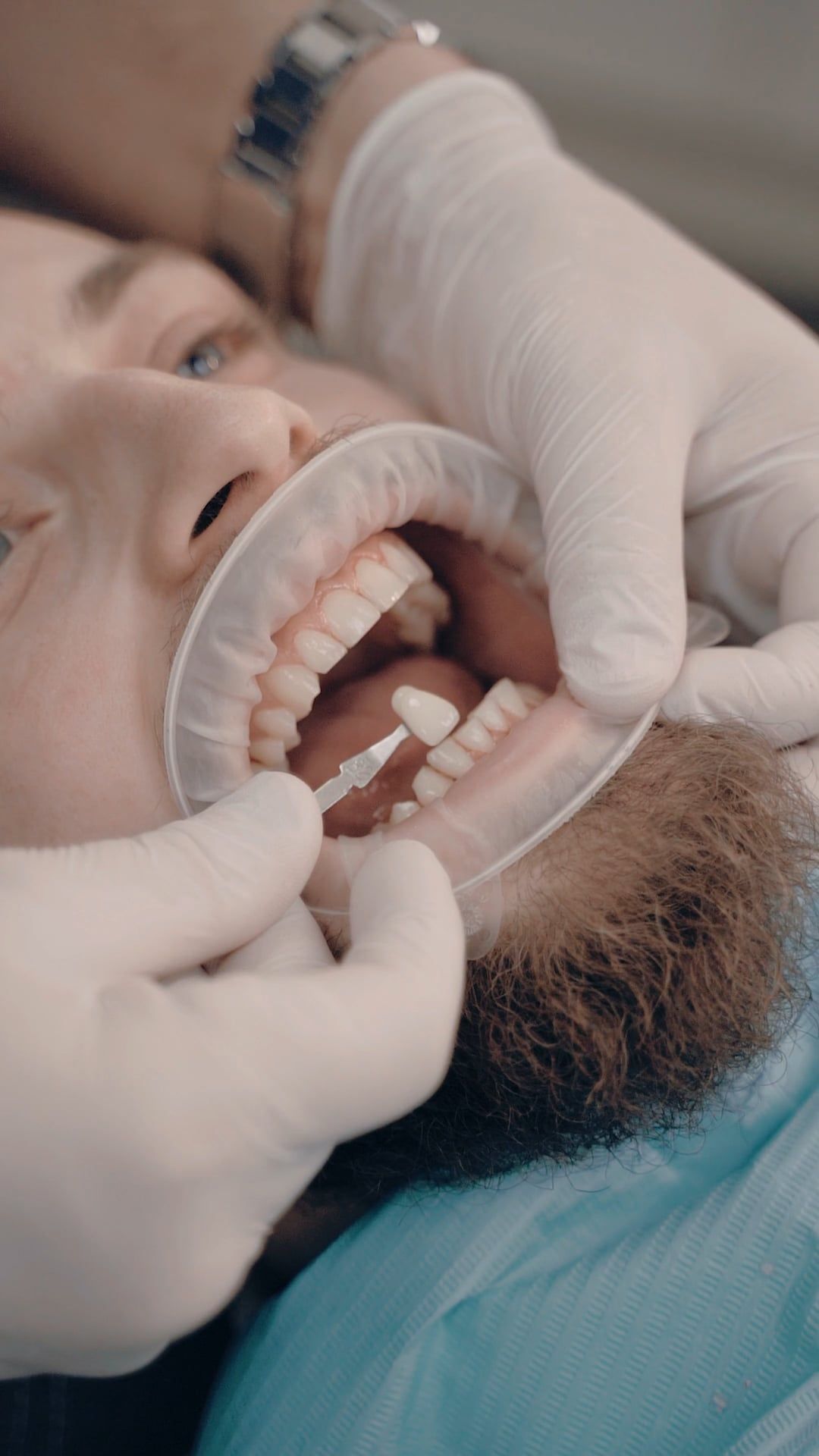 Tooth Pain Videos, Download The BEST Free 4k Stock Video Footage ...