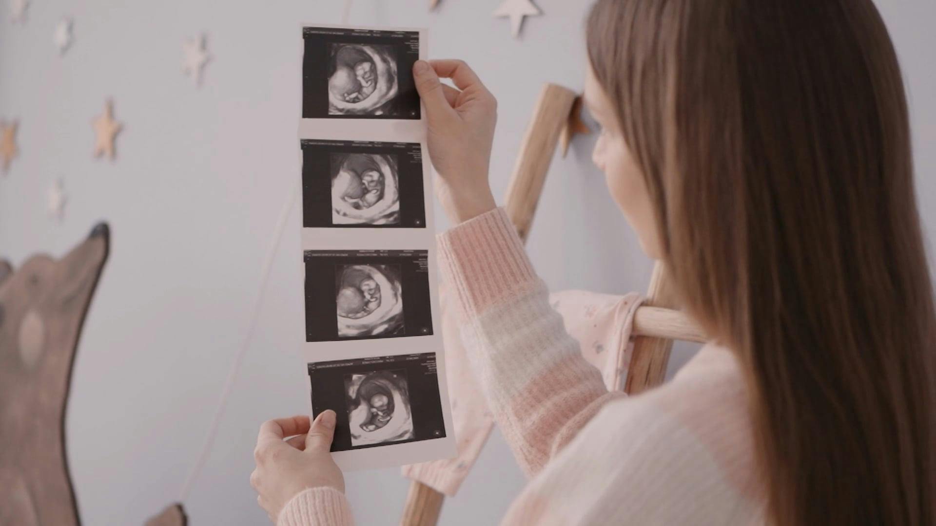 Baby Scan Photo Videos, Download The BEST Free 4k Stock Video Footage ...