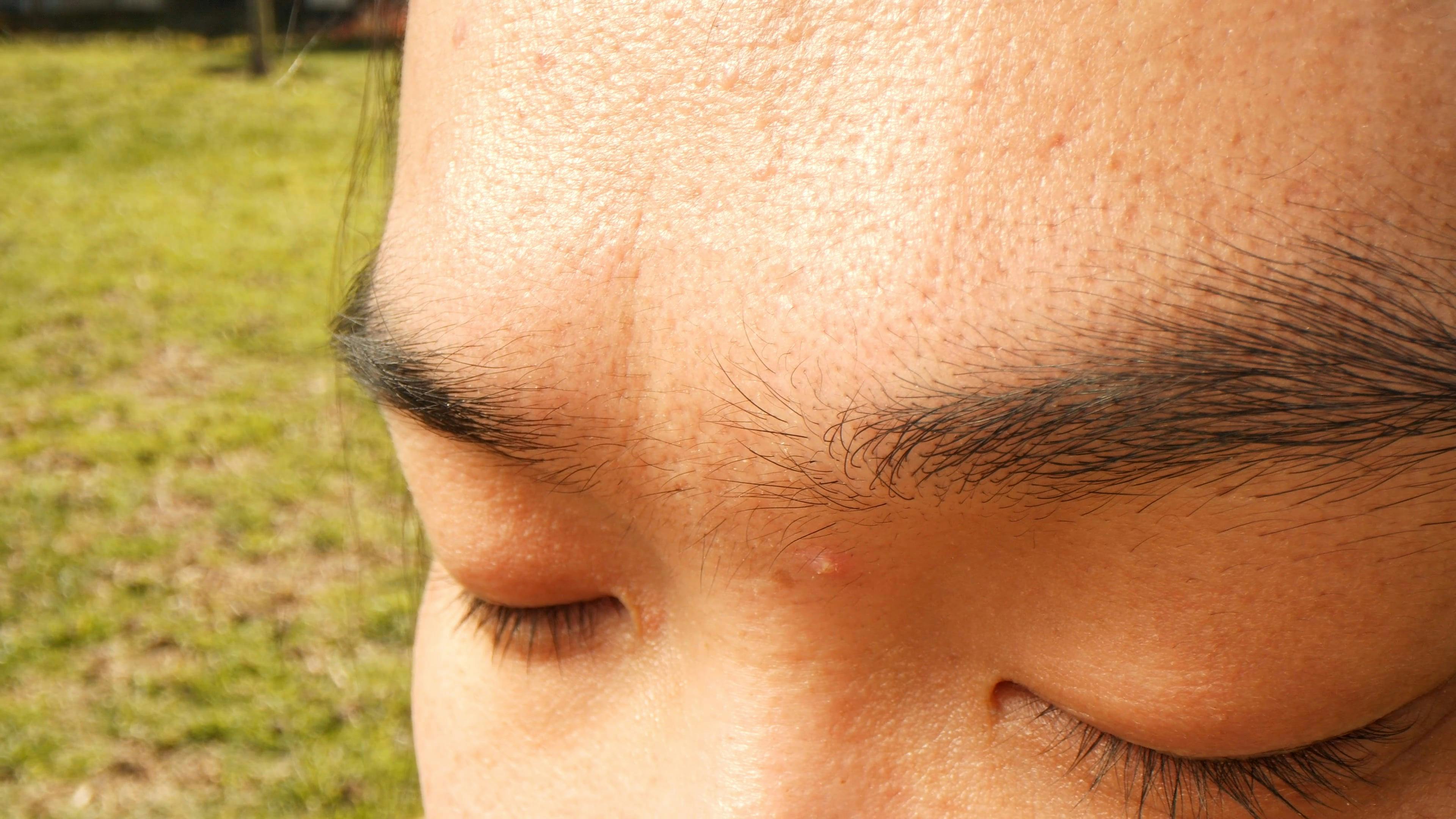 Close Up On Skin Pores Videos, Download The BEST Free 4k Stock Video ...