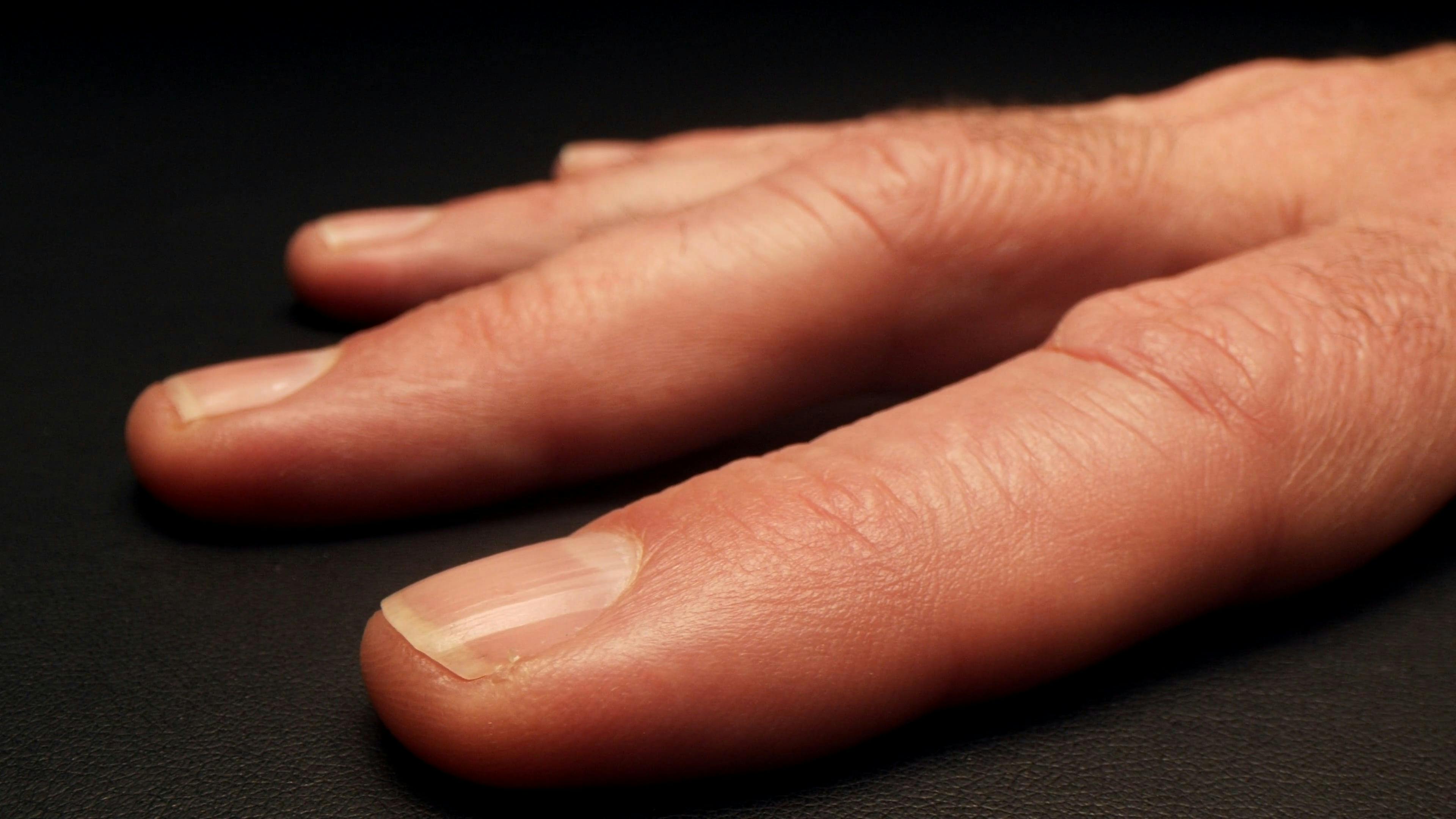 Finger Anatomy Videos, Download The BEST Free 4k Stock Video Footage ...