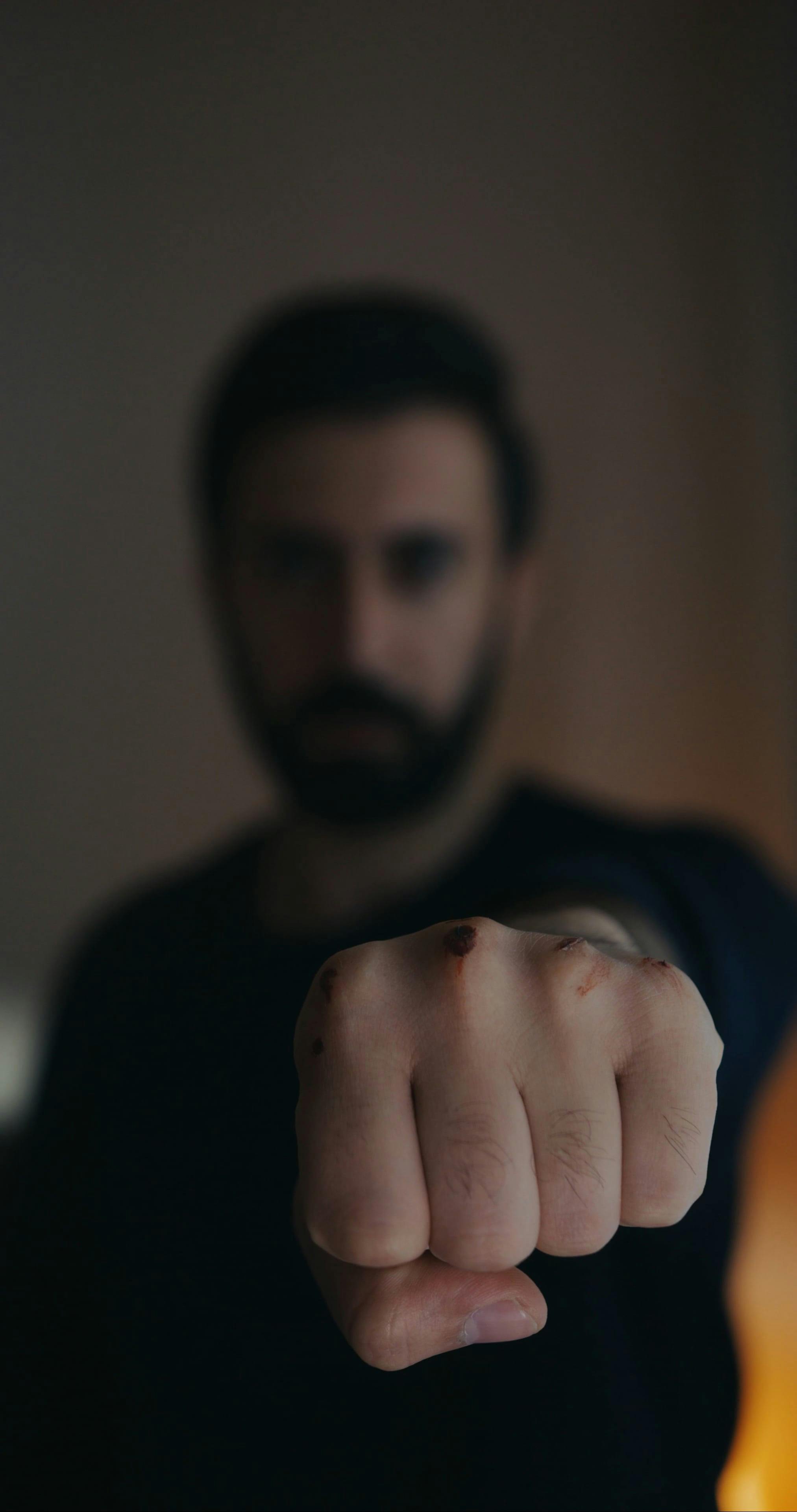 Man with a Wounded Fist · Free Stock Video