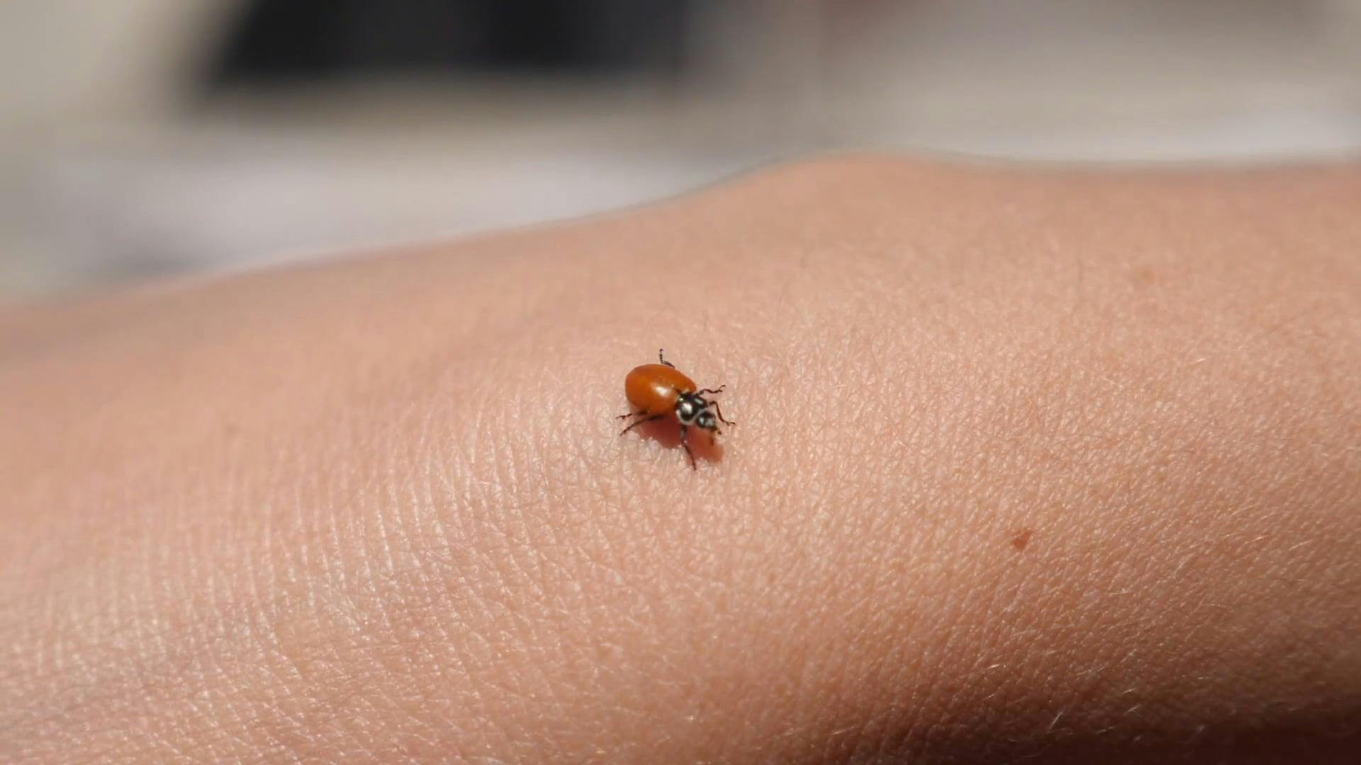 Animated Red Arm From Injection Videos, Download The BEST Free 4k Stock ...