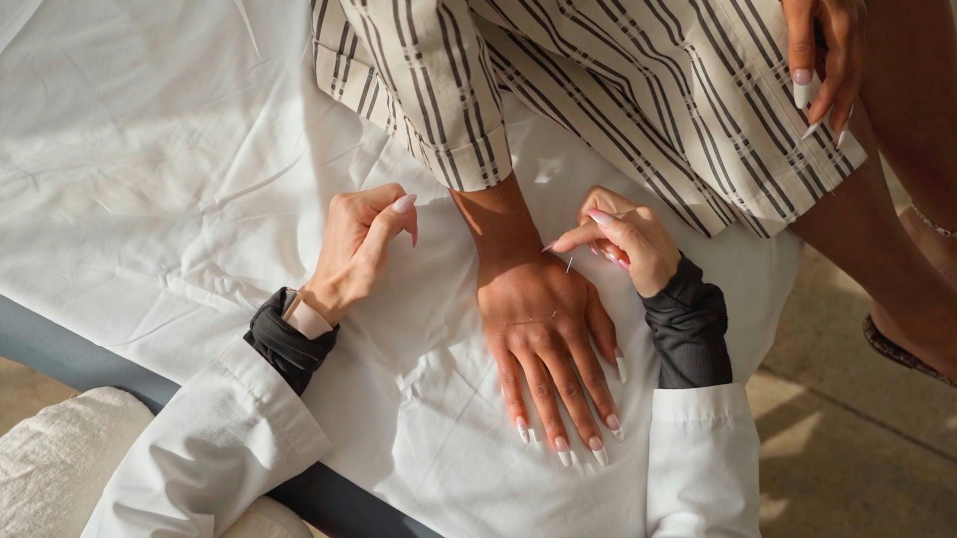 A Person Receiving Acupuncture Treatment Free Stock Video Footage ...