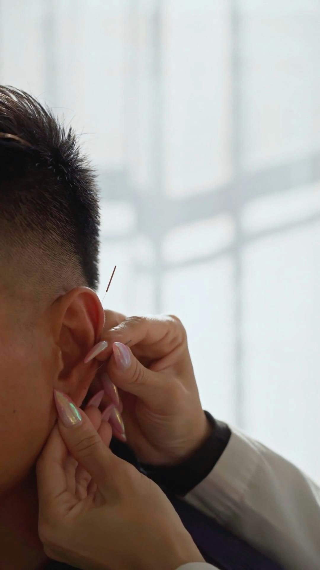 Close-up Footage of a Person Doing an Acupuncture Free Stock Video ...