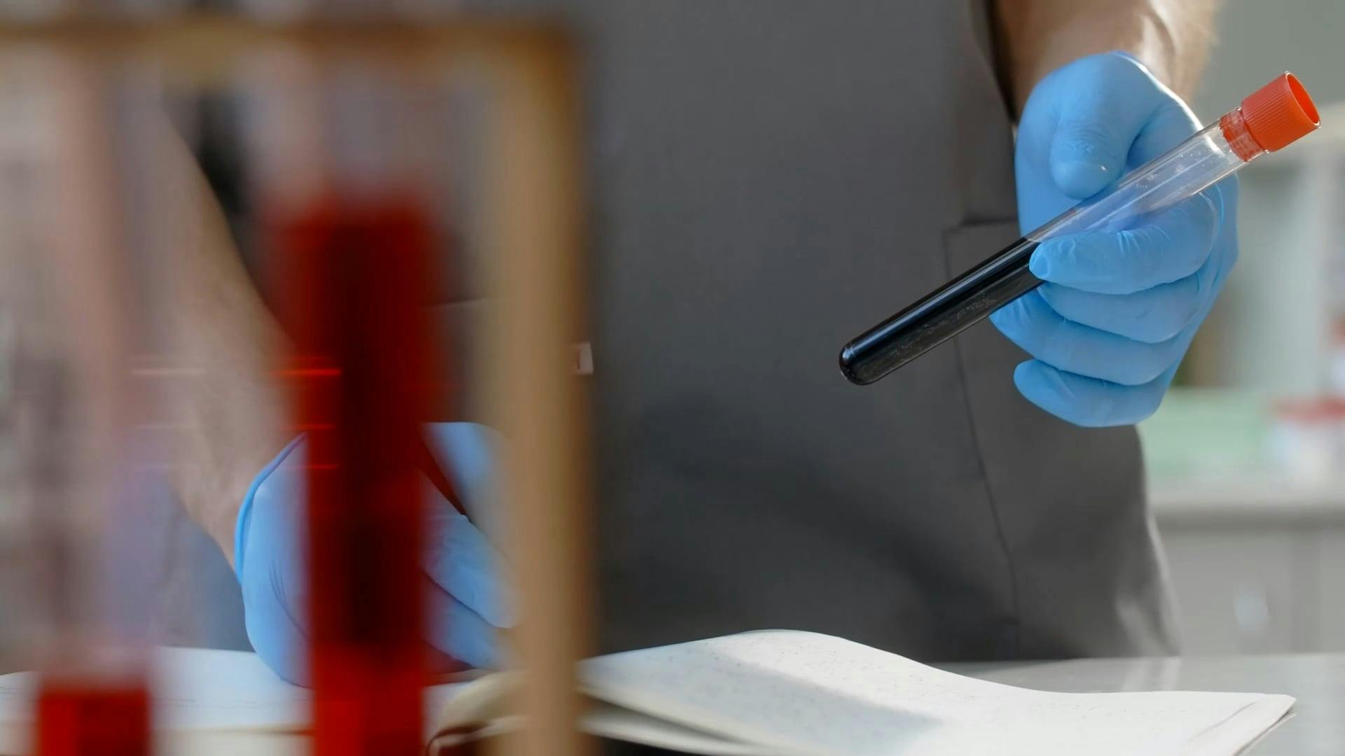 Person Holding Test Tube and taking Notes Free Stock Video Footage ...