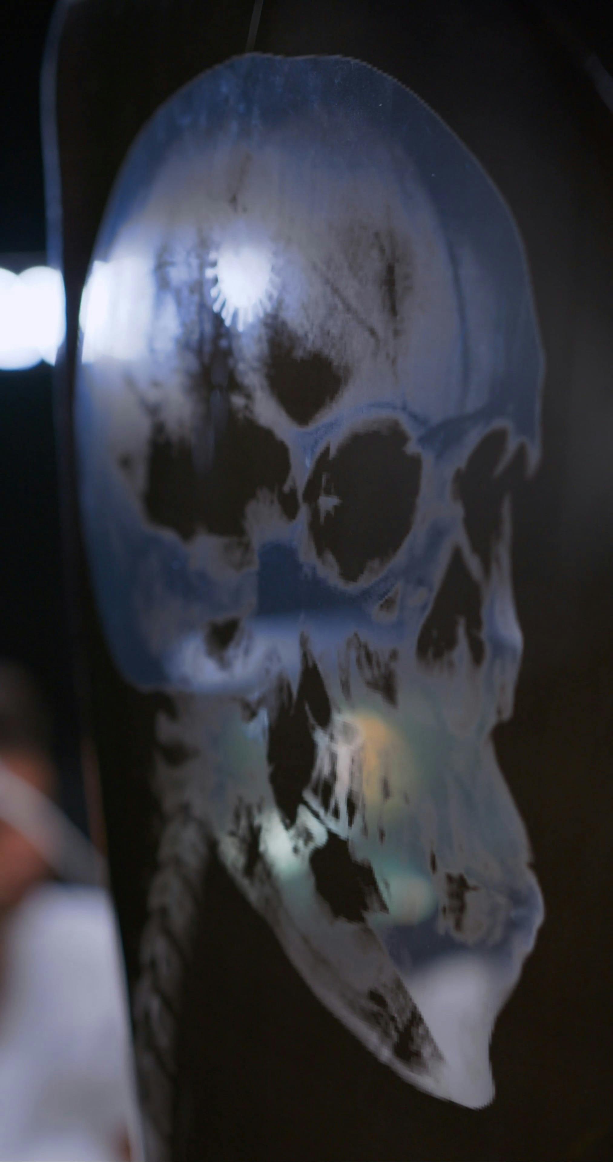 Medical Hologram Videos, Download The BEST Free 4k Stock Video Footage ...